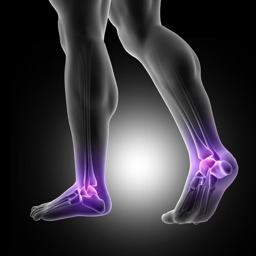 Foot Osteoarthritis: Common Symptoms And Diagnosis – OrthoFlexx